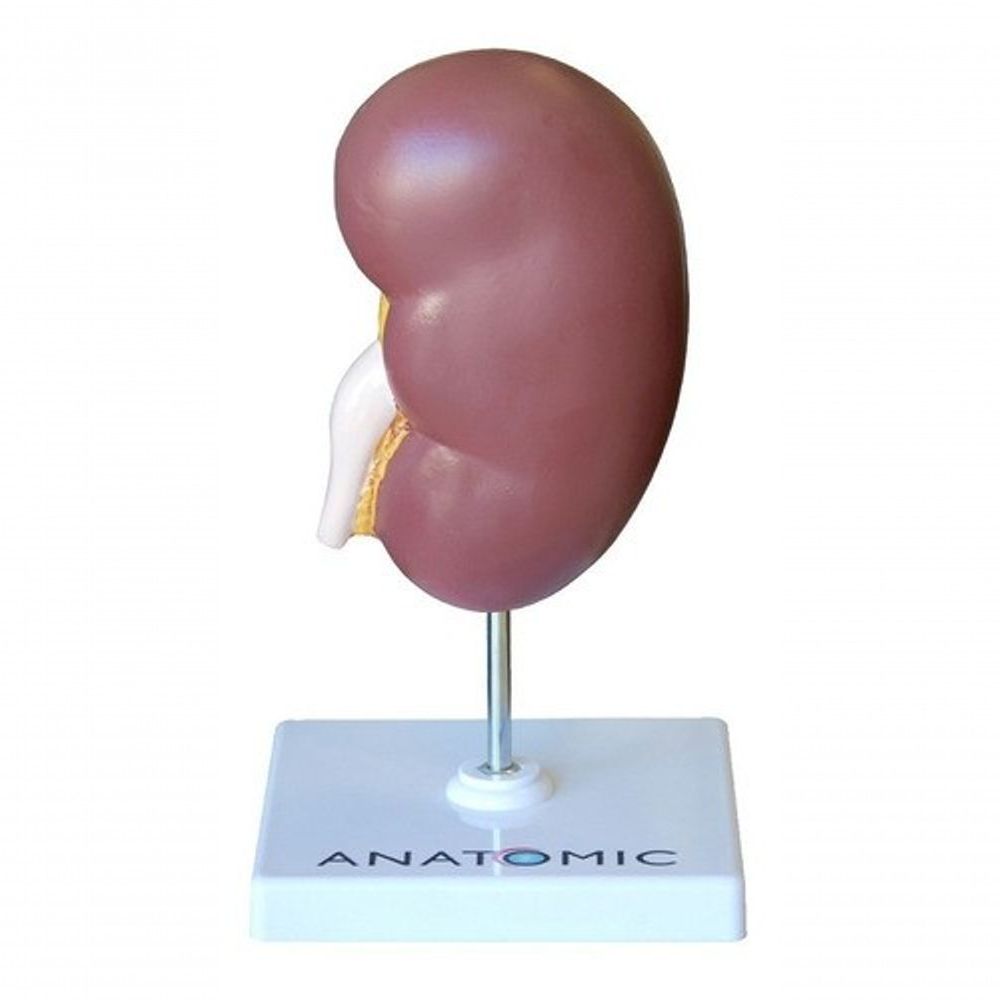 Rim Humano Com Patologias Corte Mediano, Anatomia - WebContinental